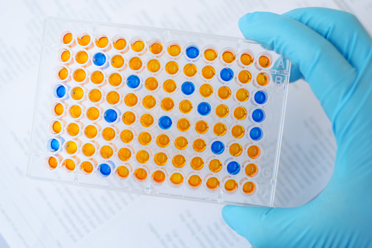 ELISA-Microplate-2 | ONCOtracker